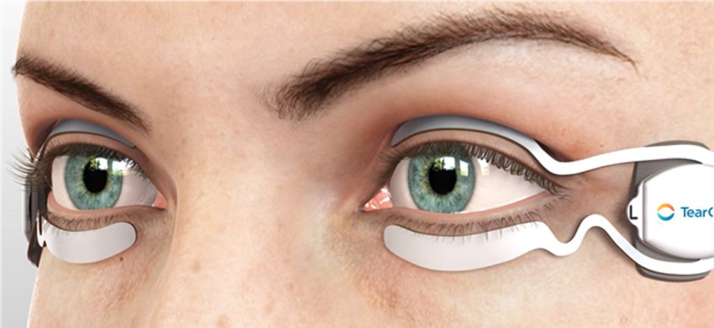 TearCare Dry Eye Treatment - Delray Eye Associates, P.A. TearCare Dry Eye Treatment - Delray Eye Associates, P.A.